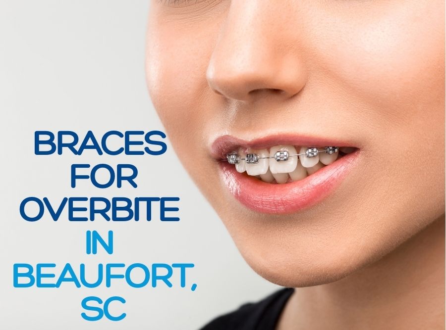 Braces for Overbite in Beaufort, SC